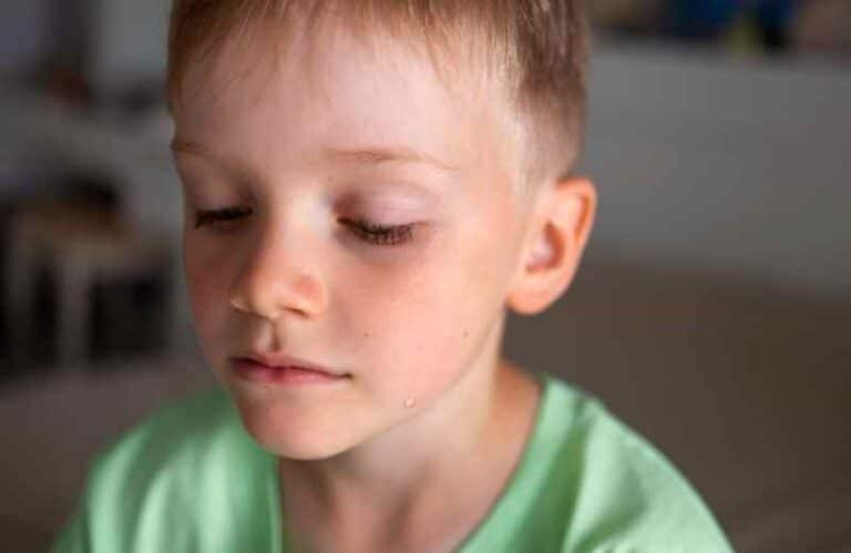 Plaque rouge sur le visage chez l’enfant avec fièvre : causes possibles ...
